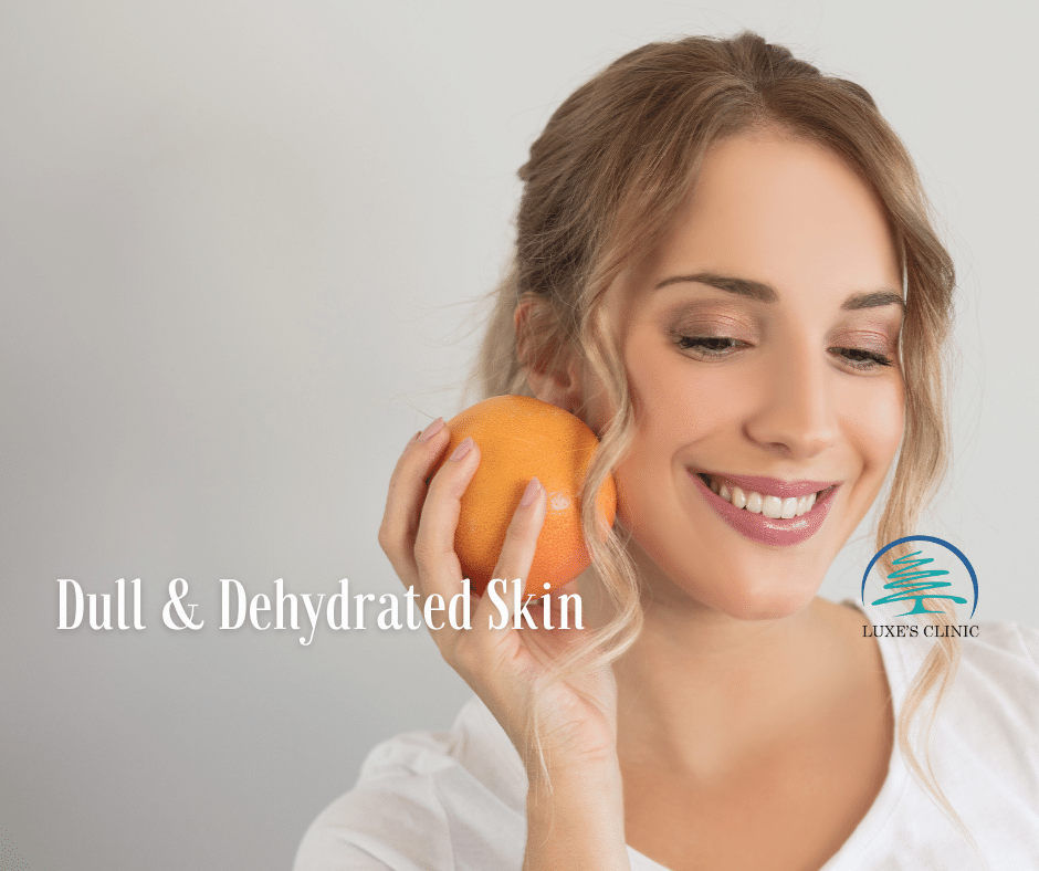 Revive Your Dull and Dehydrated Skin | Luxe’s Clinic