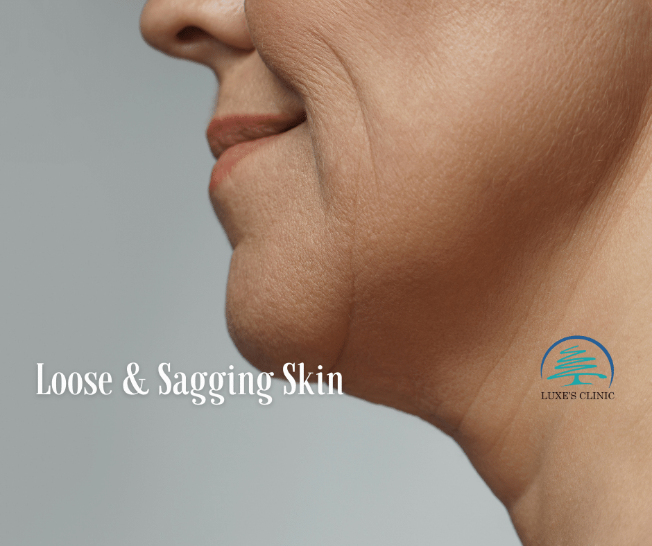 Luxe's Clinic - Effective Solutions for Loose and Sagging Skin